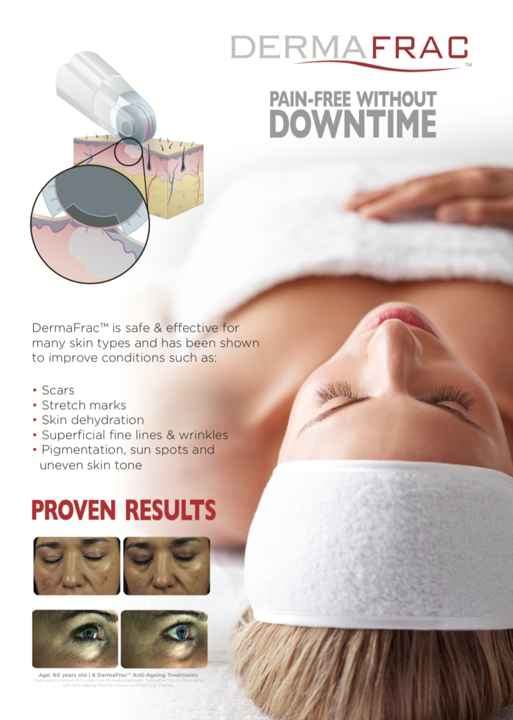 Dermafrac® - Megan Dempsey